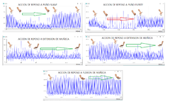 Sensores Mioelectricos de Bajo Costo - UtopiaMaker's Wiki